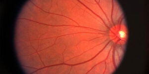 The Anatomy of the Eye | Posterior Segment – Precision Family Eyecare