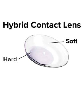 Specialty Contact Lenses – Precision Family Eyecare